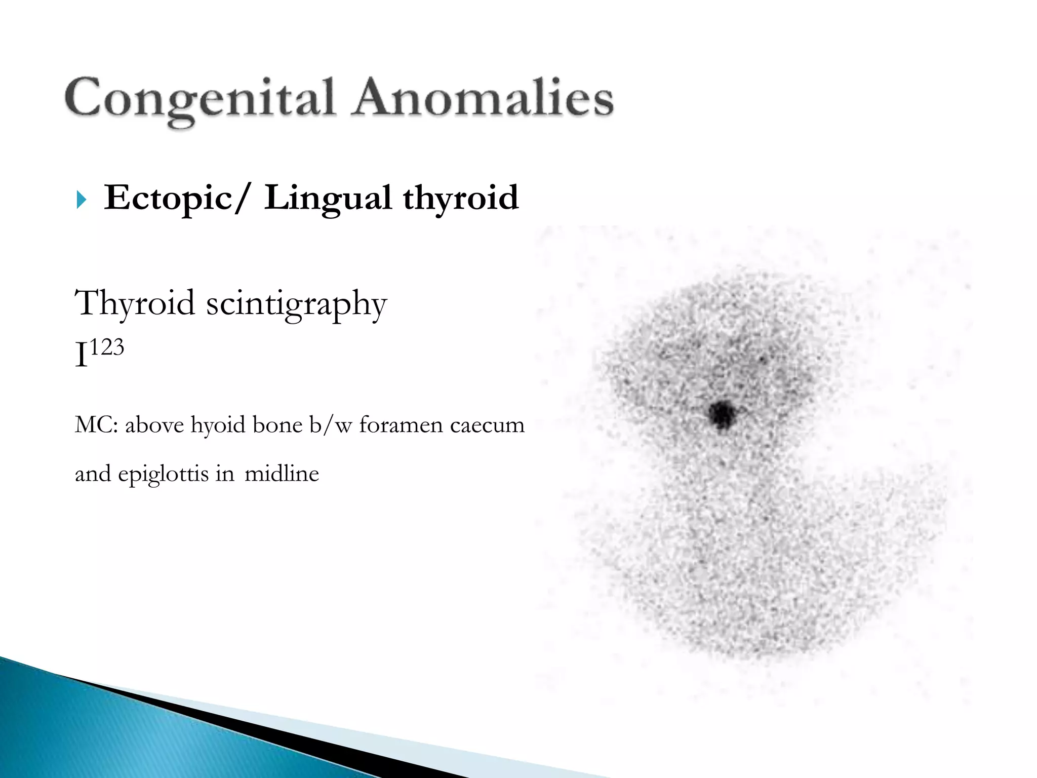 Usg neck | PPTX | Thyroid Disorders | Endocrine and Metabolic Diseases