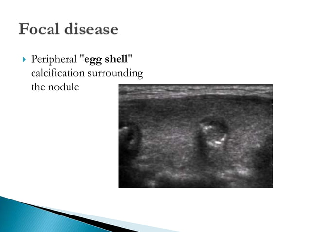 Usg neck | PPTX | Thyroid Disorders | Endocrine and Metabolic Diseases