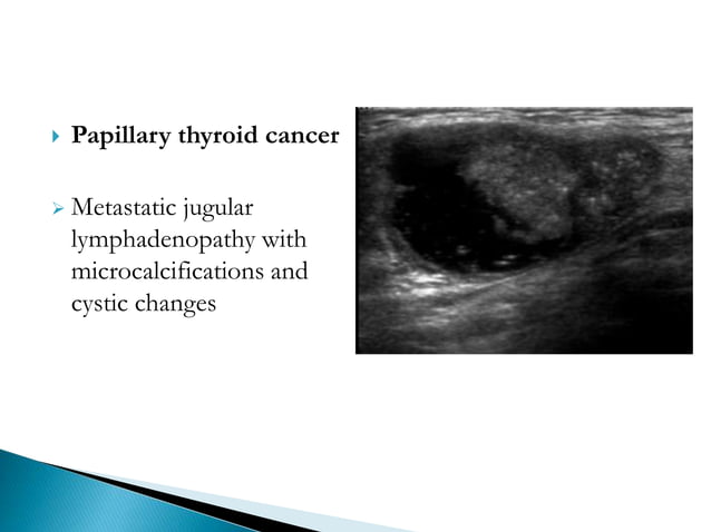 Usg neck | PPTX | Thyroid Disorders | Endocrine and Metabolic Diseases