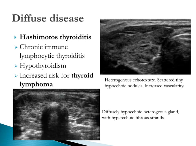 Usg neck | PPTX | Thyroid Disorders | Endocrine and Metabolic Diseases