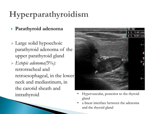Usg neck | PPTX | Thyroid Disorders | Endocrine and Metabolic Diseases