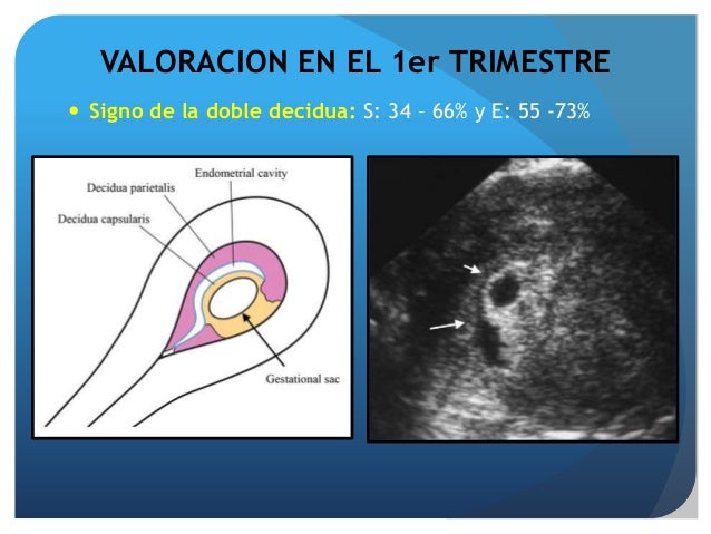 Usg obstetrico