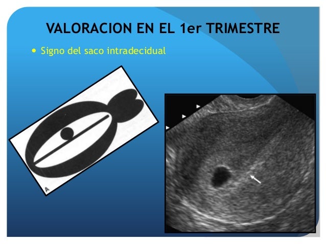 Usg obstetrico