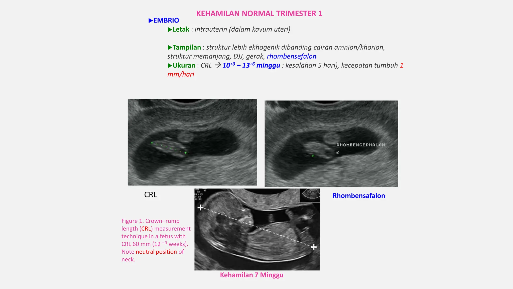 USG obndnbdndndndstetri Dasar terbatas.pptx | Free Download