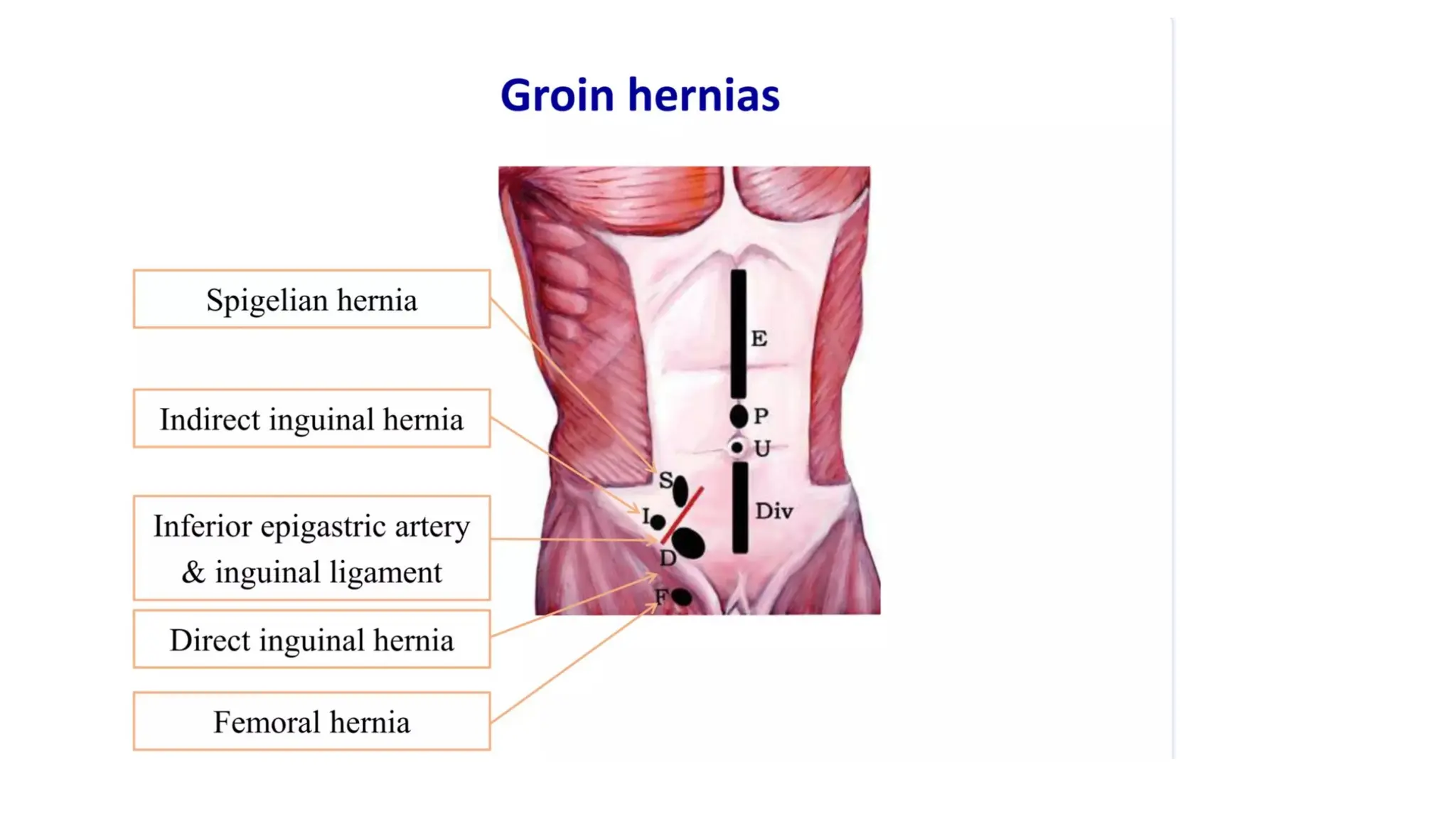 USG of hernia of groin and anterior abdominal.pptx