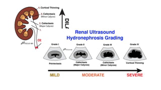 USG OF KIDNEYS.pptx