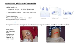 USG OF KIDNEYS.pptx