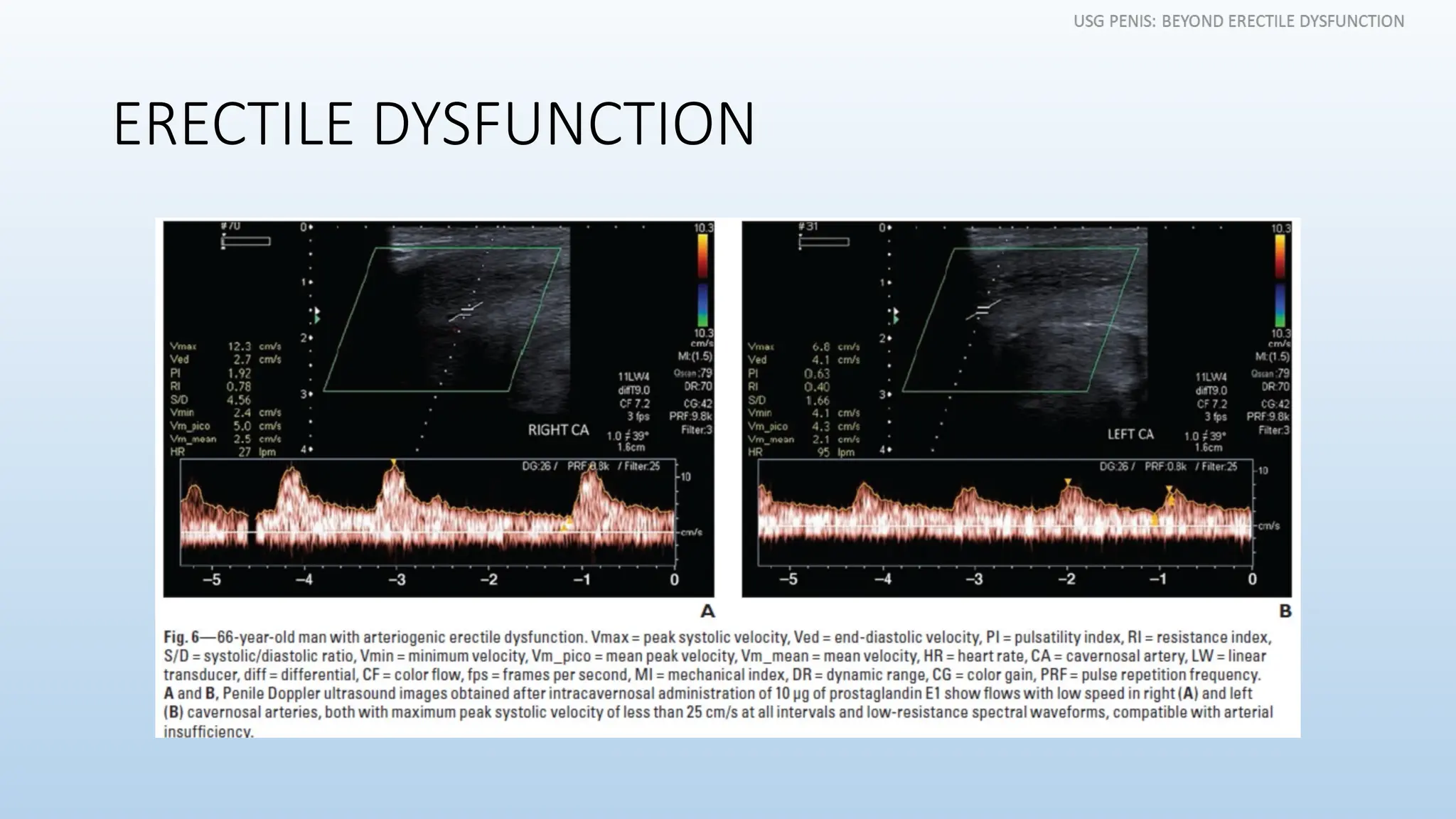 USG PENIS a review of anatomy and erectile dysfunction | PPT