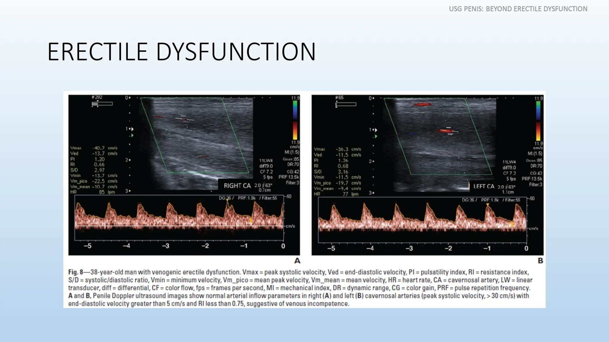 USG PENIS a review of anatomy and erectile dysfunction | PPT