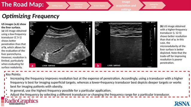 USG performing methods and protocols in realm | PPT