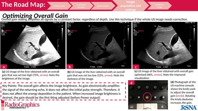 USG performing methods and protocols in realm | PPT
