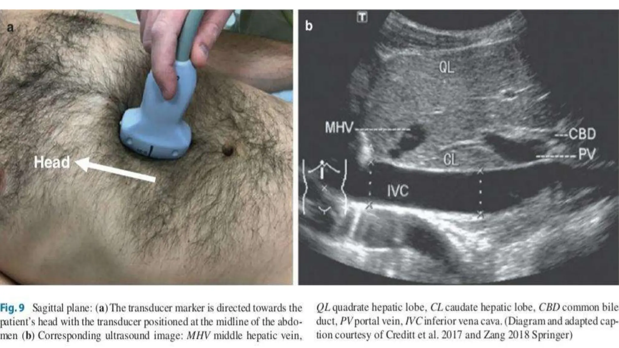 Usg physics for a non radiologist an overview | PPTX