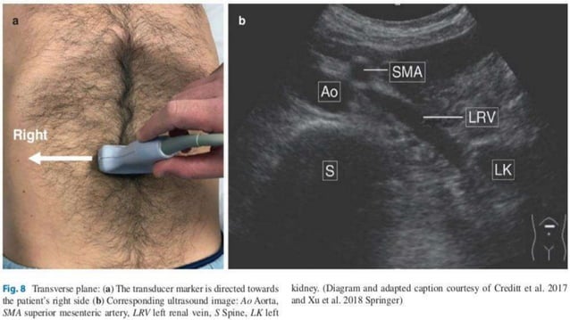 Usg physics for a non radiologist an overview | PPTX | Physics | Science