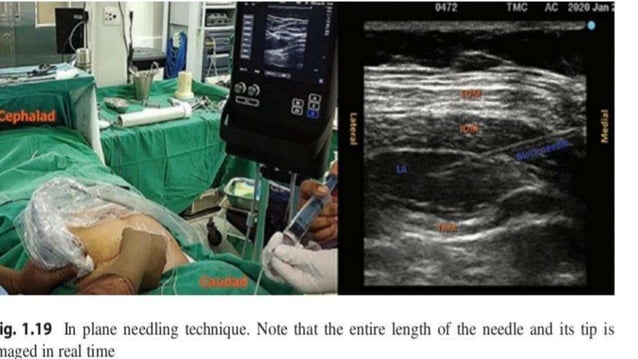 Usg physics for a non radiologist an overview | PPTX | Physics | Science