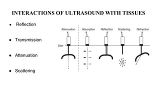 Usg physics for a non radiologist an overview | PPTX