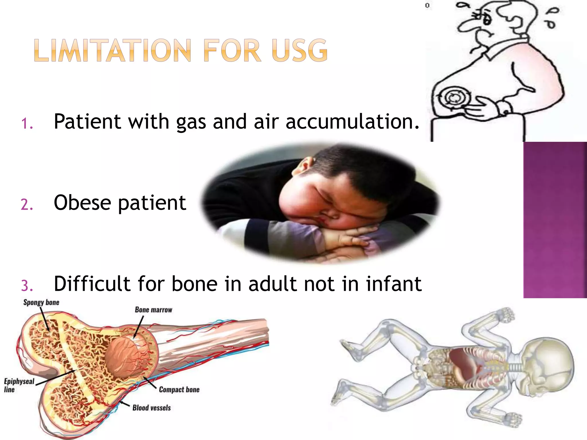 Usg ppt | PPTX