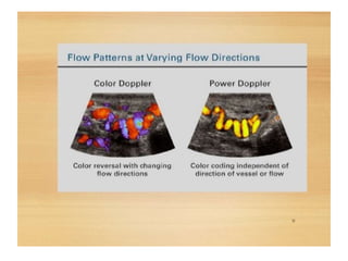 usg principle,doppler,ALARA principle.pptx