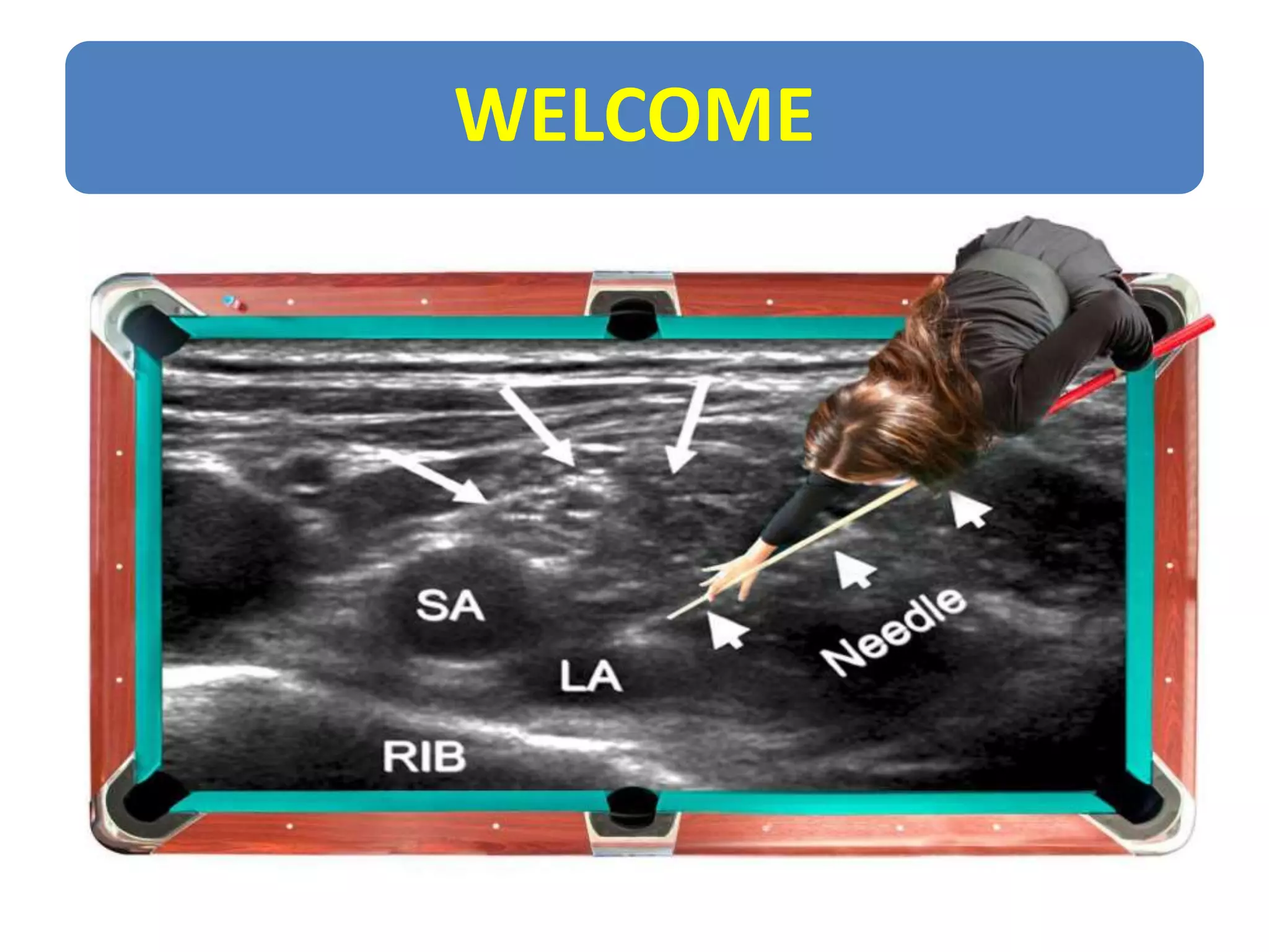 Usg r nerve block | PPTX