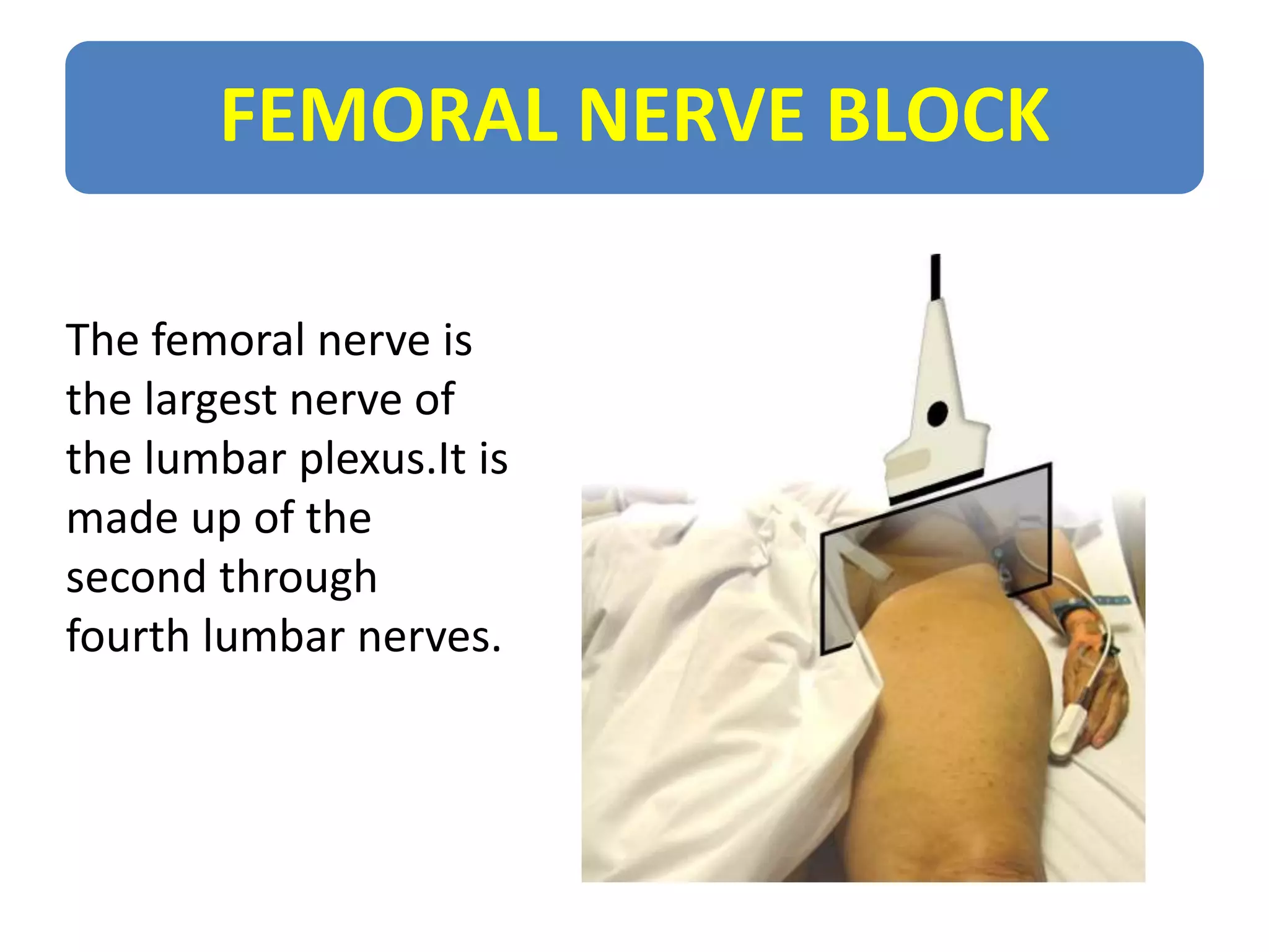 Usg r nerve block | PPTX