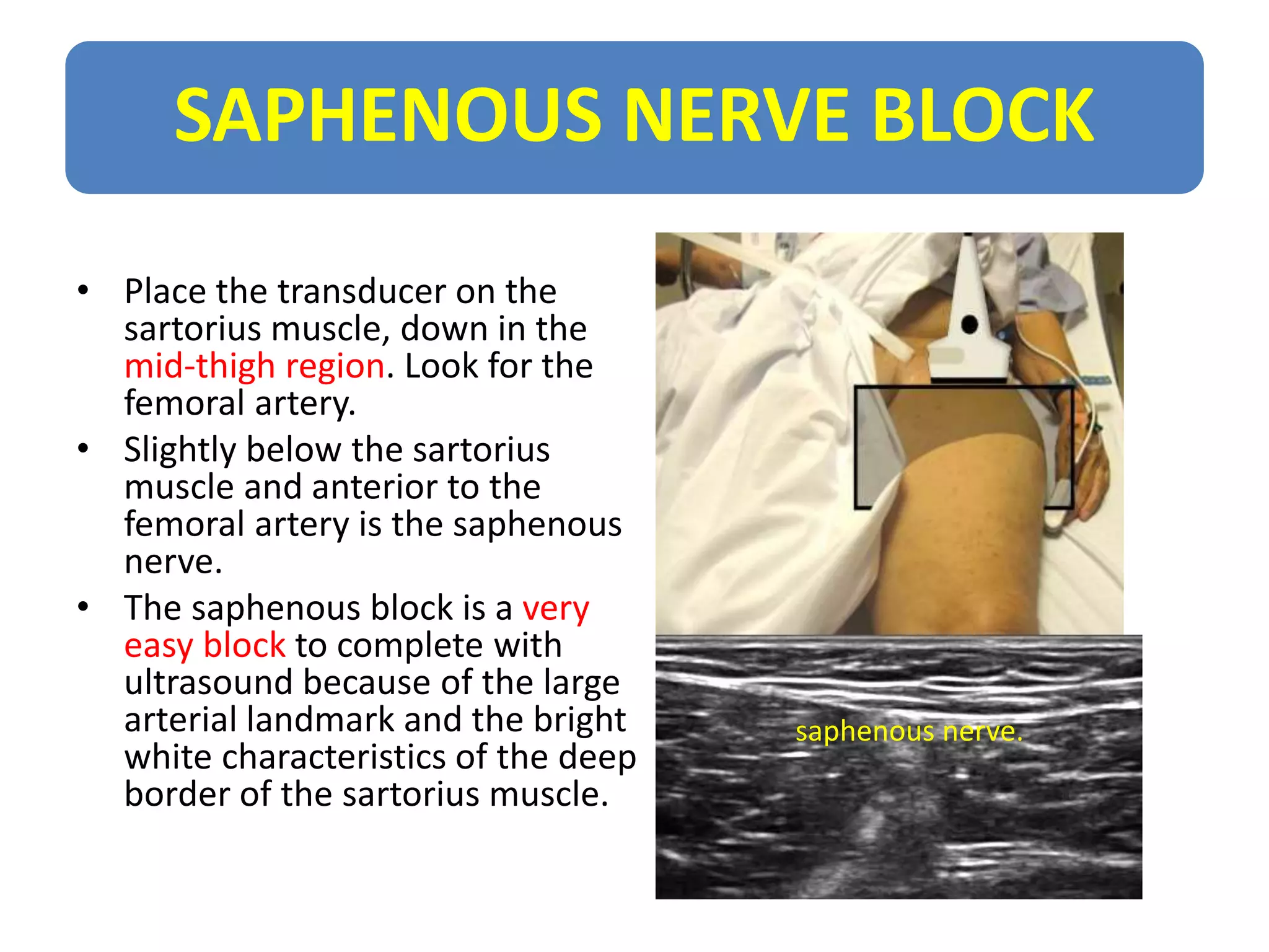 Usg r nerve block | PPTX