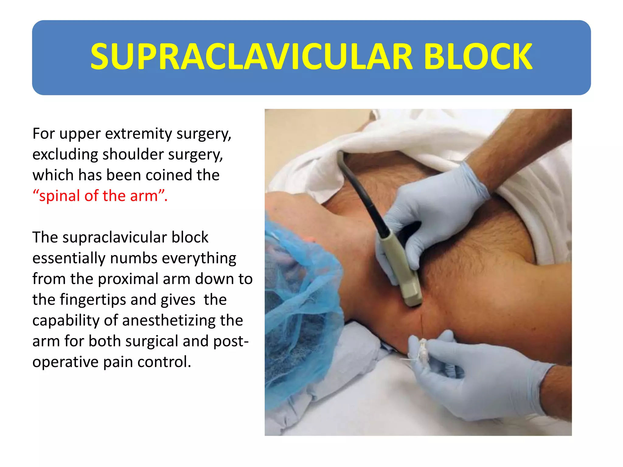Usg r nerve block | PPTX
