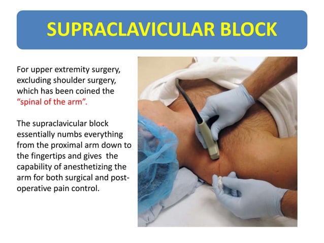 Usg r nerve block | PPTX | Death, Injury, or Military Conflict ...
