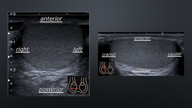 Ultrasound Scrotum Ppt