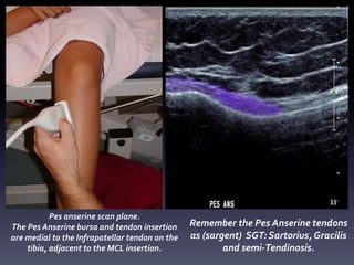 Ultrasound shoulder and knee joints | PPT