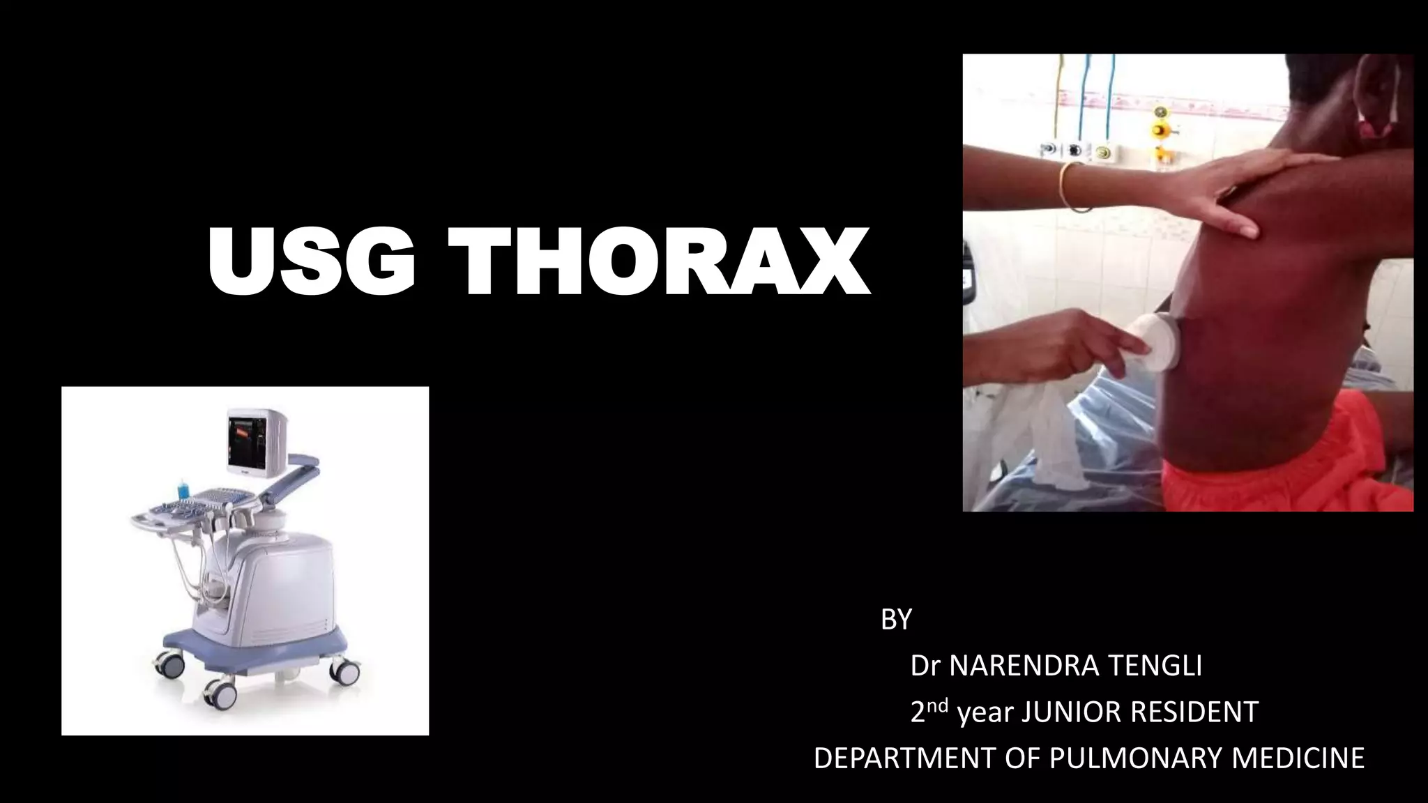 USG THORAX [Autosaved].pptx