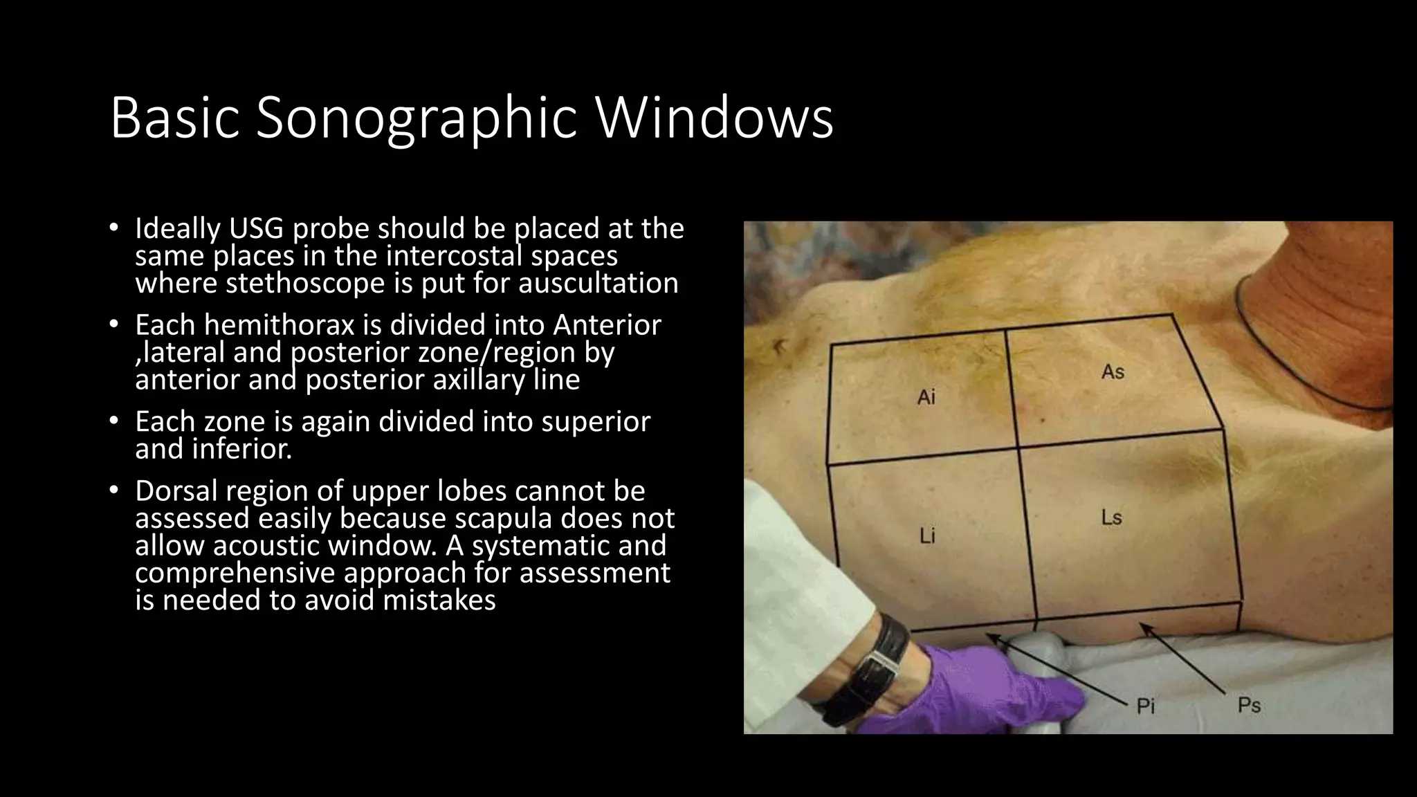 USG THORAX [Autosaved].pptx