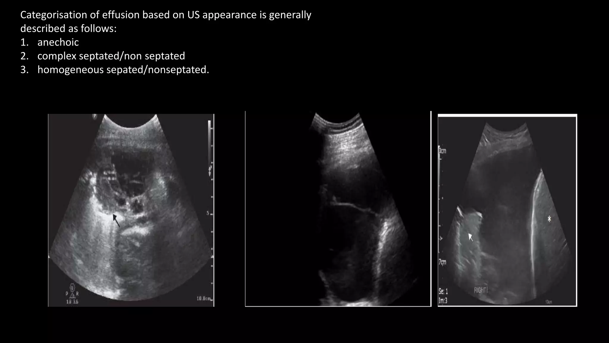USG THORAX [Autosaved].pptx | Lung and Respiratory Health | Diseases ...