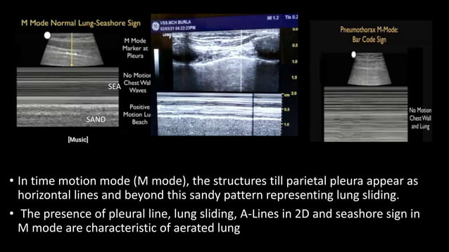 USG THORAX [Autosaved].pptx | Lung and Respiratory Health | Diseases ...