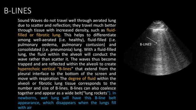 USG THORAX [Autosaved].pptx | Lung and Respiratory Health | Diseases ...