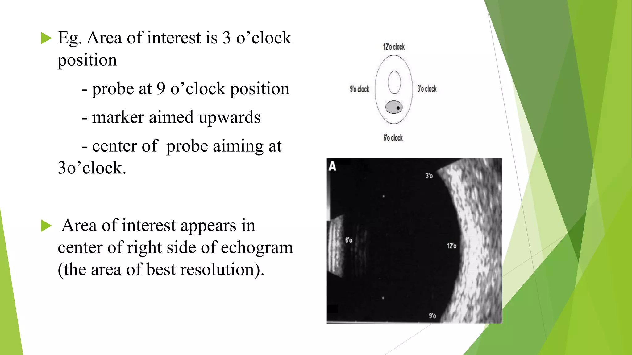 ULTRASONOGRAPHY (USG) AND ULTRASOUND BIOMICROSCOPY(UBM) | PPTX
