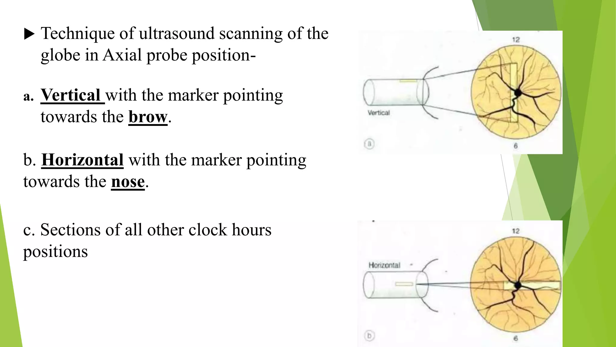 ULTRASONOGRAPHY (USG) AND ULTRASOUND BIOMICROSCOPY(UBM) | PPTX