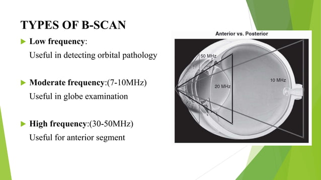 ULTRASONOGRAPHY (USG) AND ULTRASOUND BIOMICROSCOPY(UBM) | PPTX