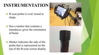 ULTRASONOGRAPHY (USG) AND ULTRASOUND BIOMICROSCOPY(UBM) | PPTX