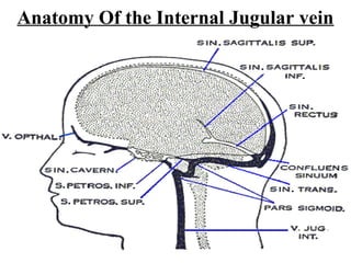 Us guided central venous cannulation | PPT