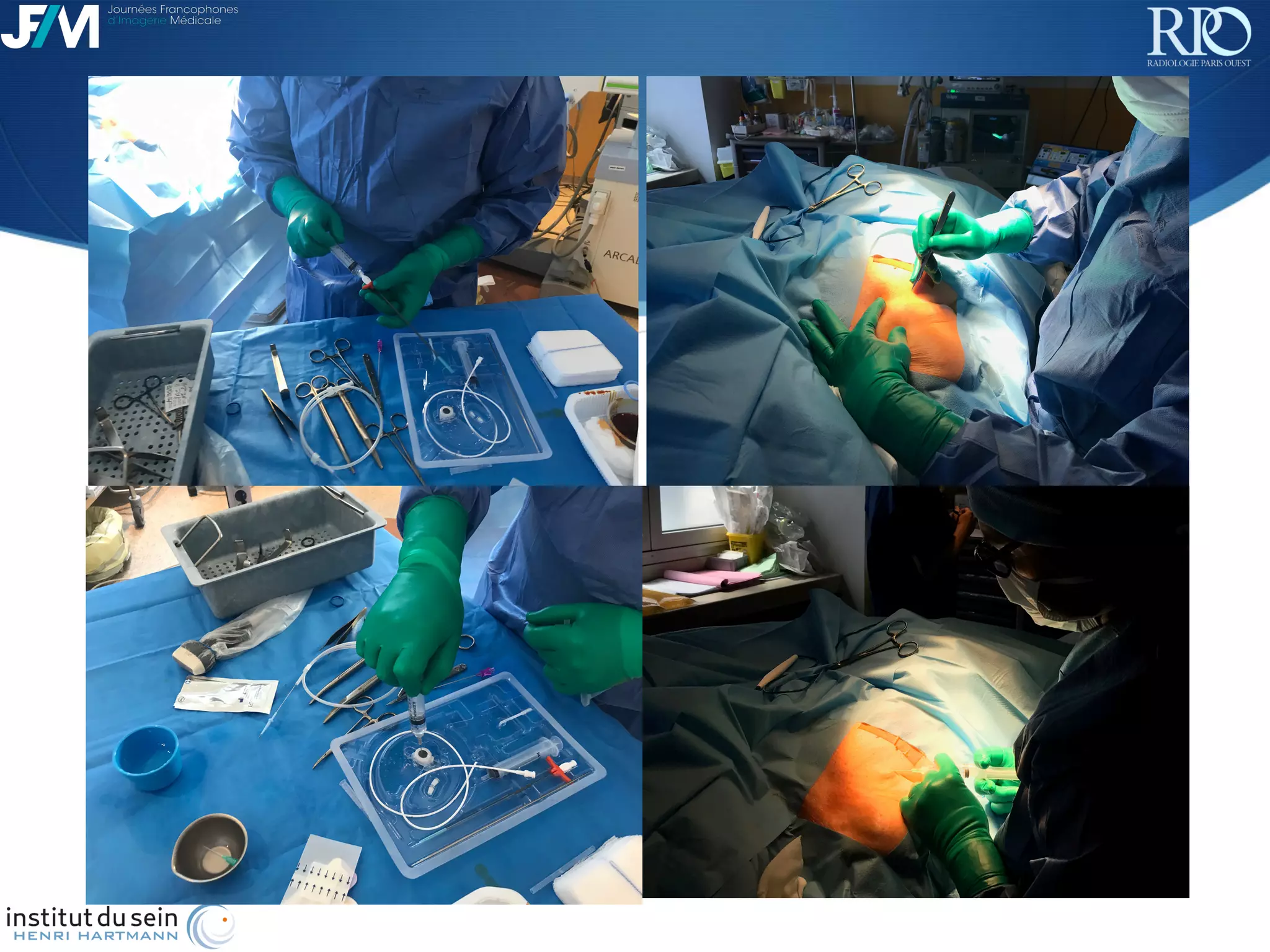 Luc Rotenberg, Gregory Lenczner ULTRASOUND GUIDED VENOUS ACCESS CHEST ...