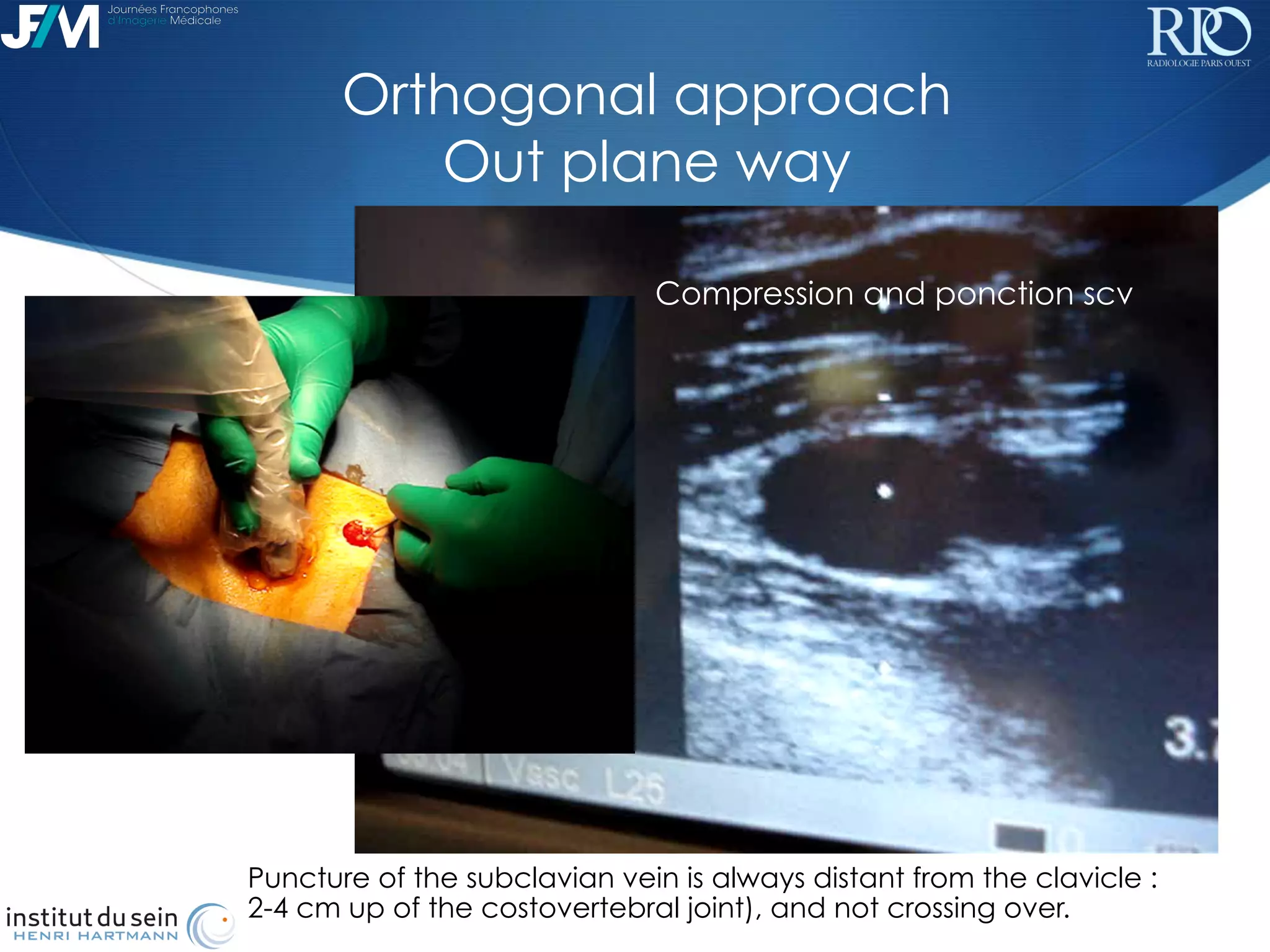 Luc Rotenberg, Gregory Lenczner ULTRASOUND GUIDED VENOUS ACCESS CHEST ...
