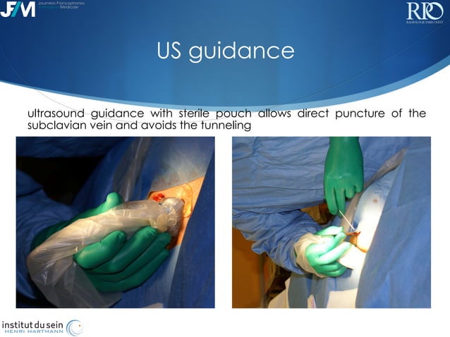 Luc Rotenberg, Gregory Lenczner ULTRASOUND GUIDED VENOUS ACCESS CHEST ...