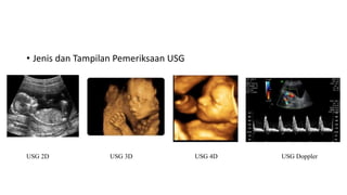 USG (Ultrasonografi).pptx