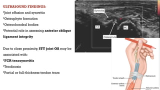 Role of USG in Wrist Joint Pathology and Interventions | PPTX