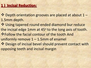 tooth preparation-partial veneers | PPT