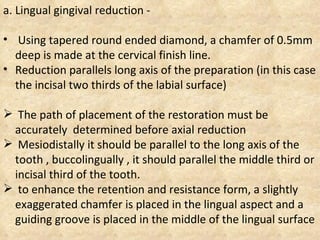 tooth preparation-partial veneers | PPT