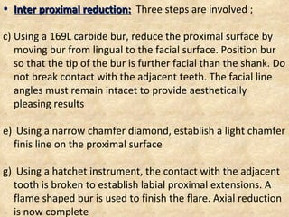 tooth preparation-partial veneers | PPT