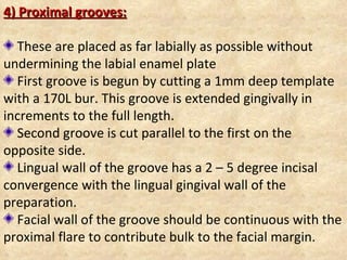 tooth preparation-partial veneers | PPT