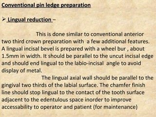 tooth preparation-partial veneers | PPT