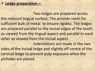 tooth preparation-partial veneers | PPT