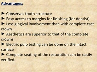 tooth preparation-partial veneers | PPT